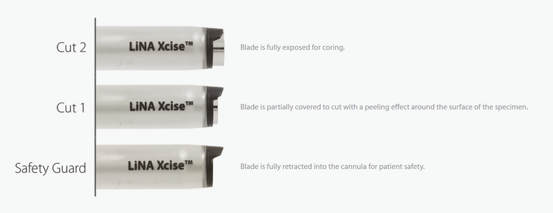 LiNA Xcise – GRC Surgical | the smart way to operate